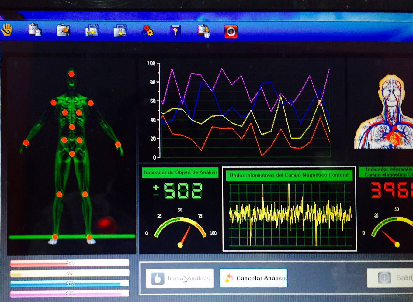ESCANER DEL CUERPO: SISTEMA CUÁNTICO BIO-ELÉCTRICO SQX – CENTRO NATURISTA